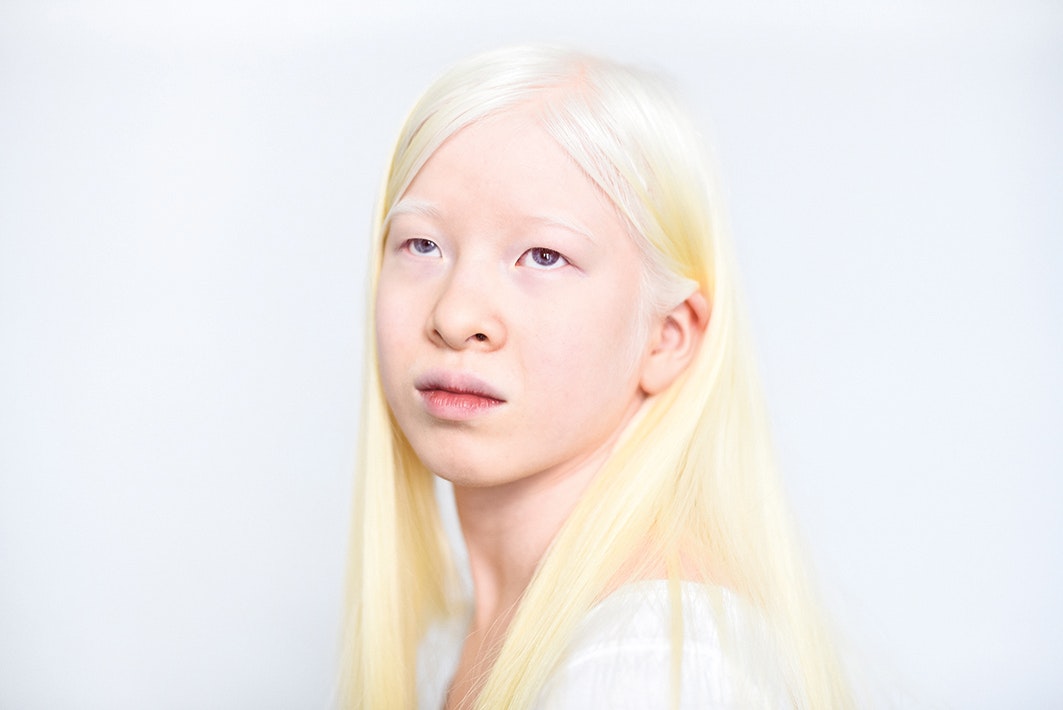 Xueli Abbing: ‘Ik wil laten zien dat mensen met albinisme niet anders zijn’